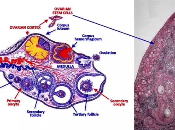 Ovarian PRP Treatment - North Cyprus IVF Center