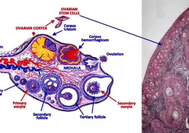Ovarian PRP Treatment - North Cyprus IVF Center